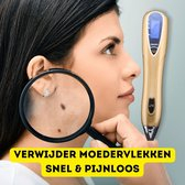 Moedervlekken Verwijderen Laser Plasma Pen Wratten Verwijder Pen ...
